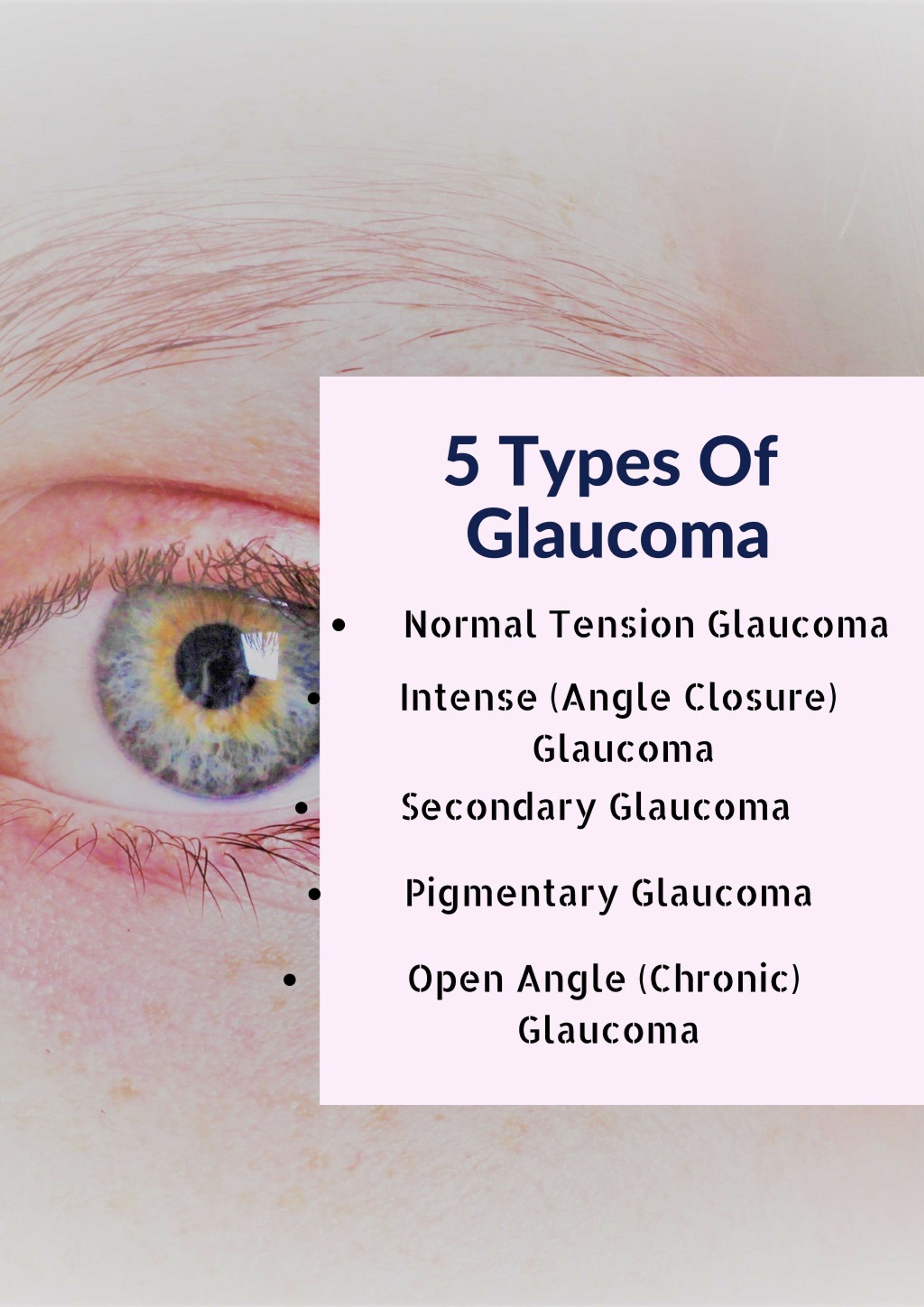 PPT - 5 Types Of Glaucoma PowerPoint Presentation, free download - ID ...
