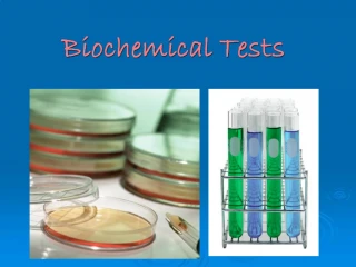 PPT - Summary of Biochemical Tests in Microbiology PowerPoint ...