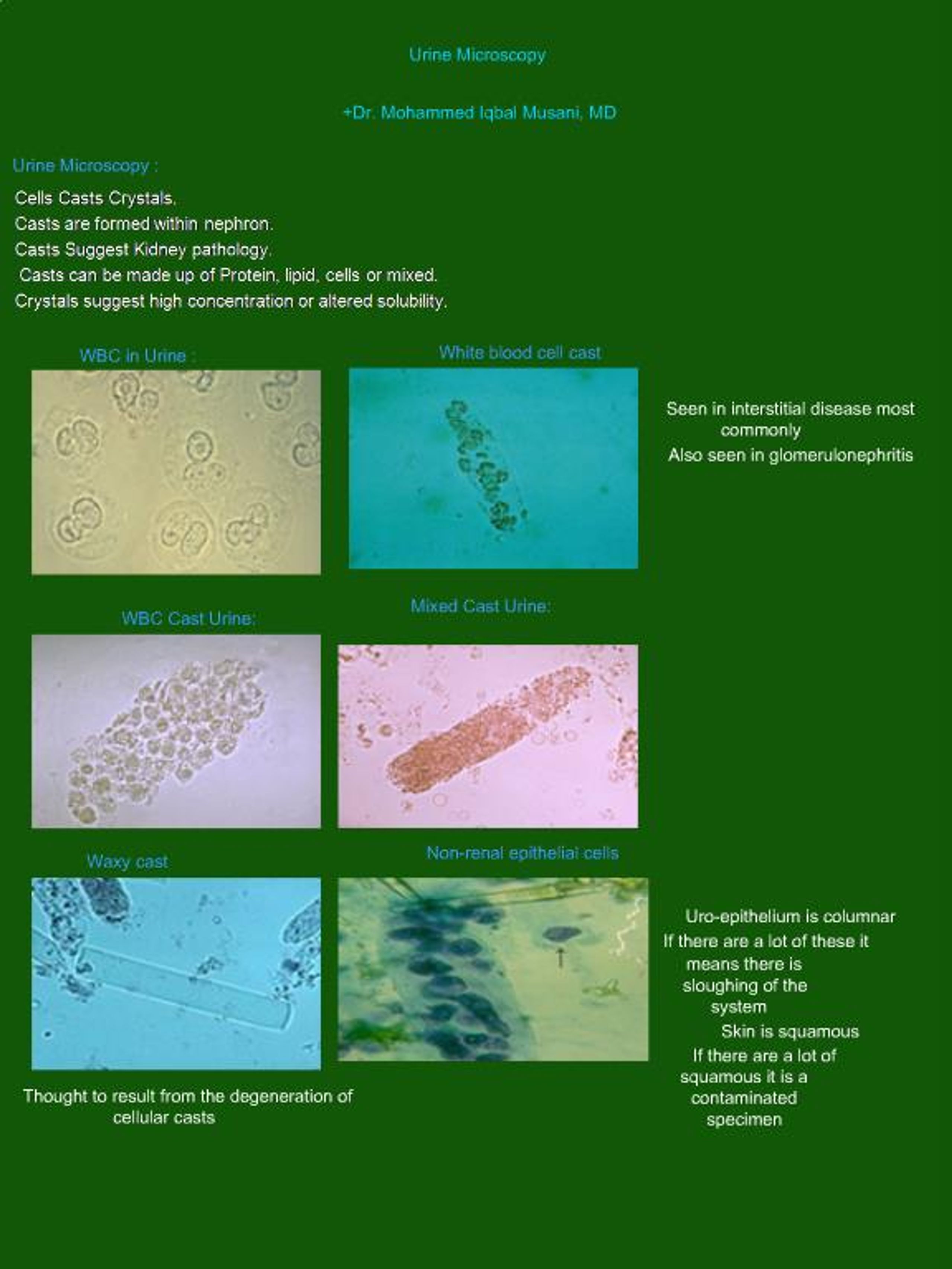 PPT - Urine Microscopy PowerPoint Presentation, free download - ID:822567