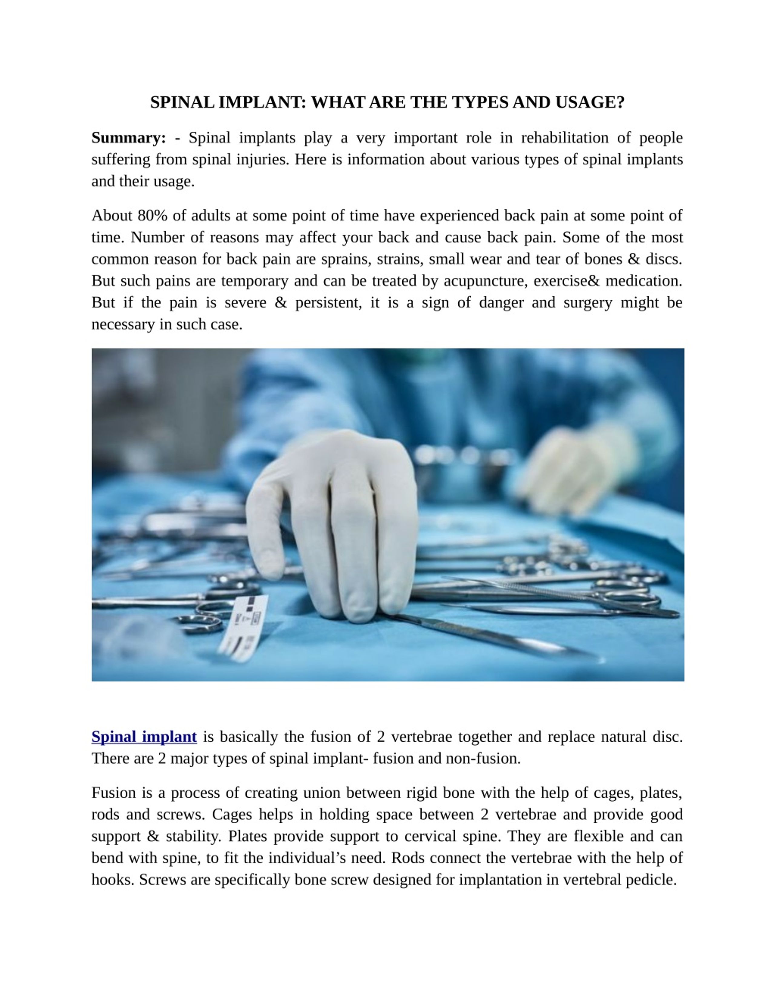 PPT - SPINAL IMPLANT: WHAT ARE THE TYPES AND USAGE? PowerPoint ...