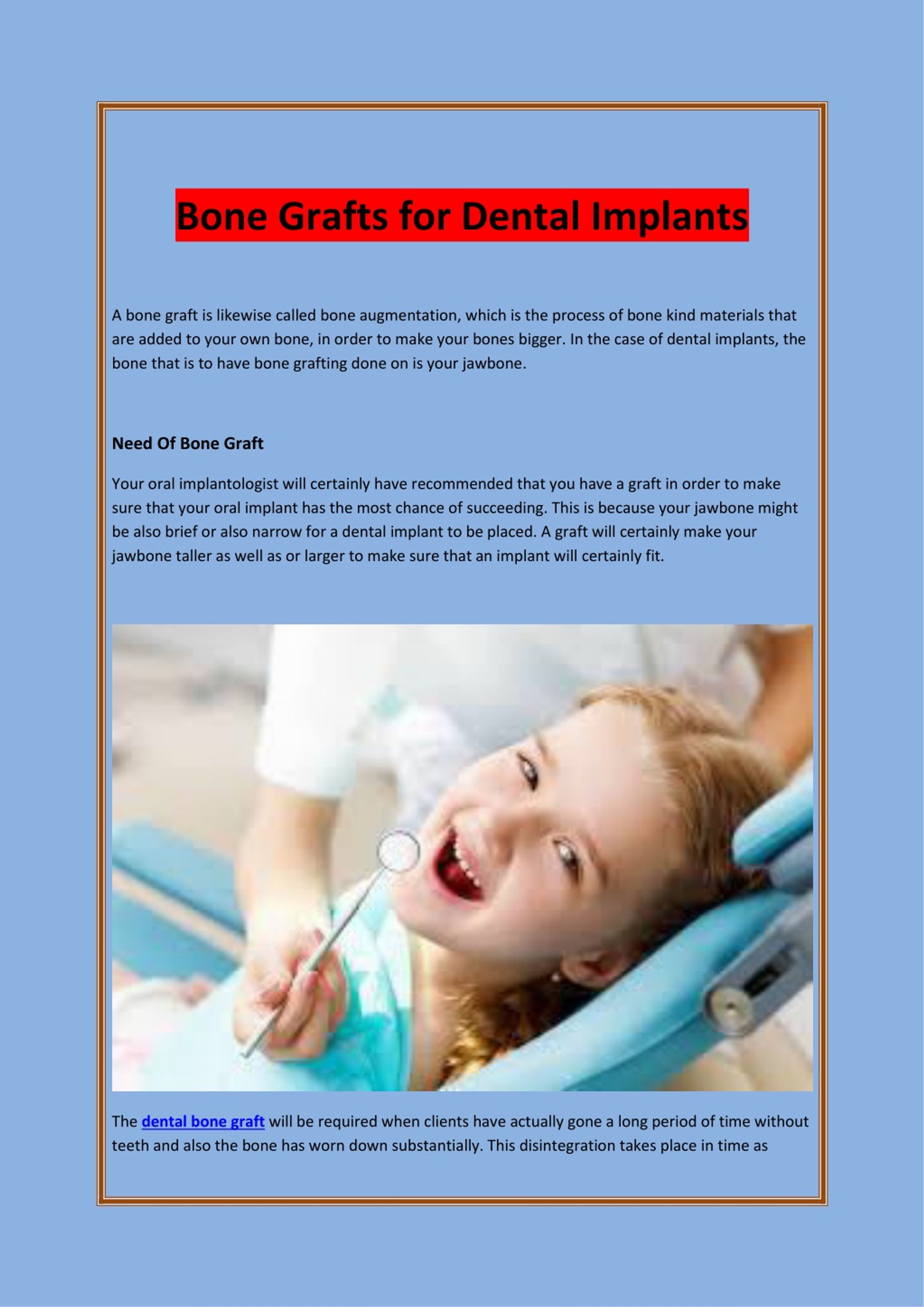 PPT - Bone Grafts for Dental Implants PowerPoint Presentation, free ...