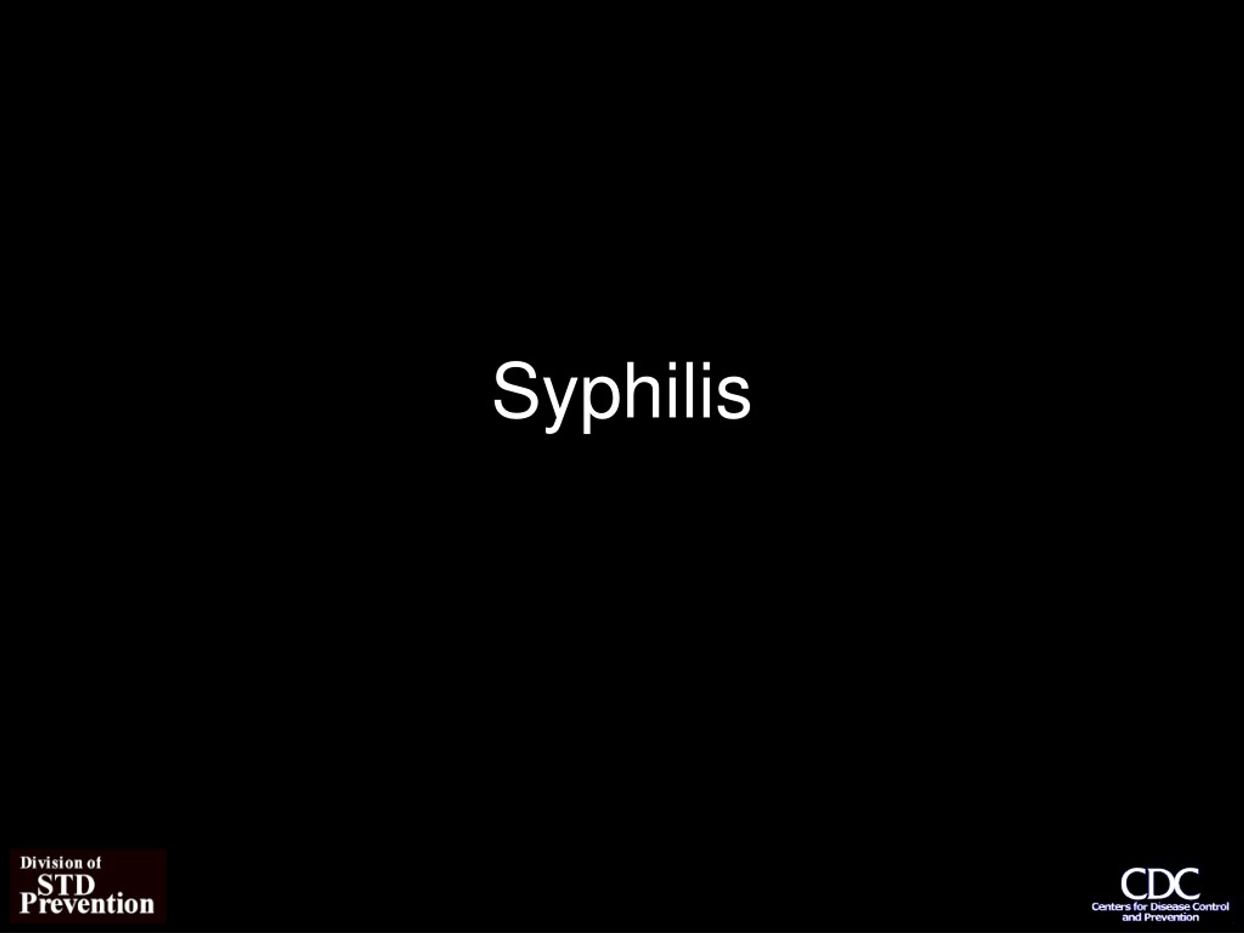 PPT - Syphilis: Symptoms, Stages, and Complications PowerPoint ...