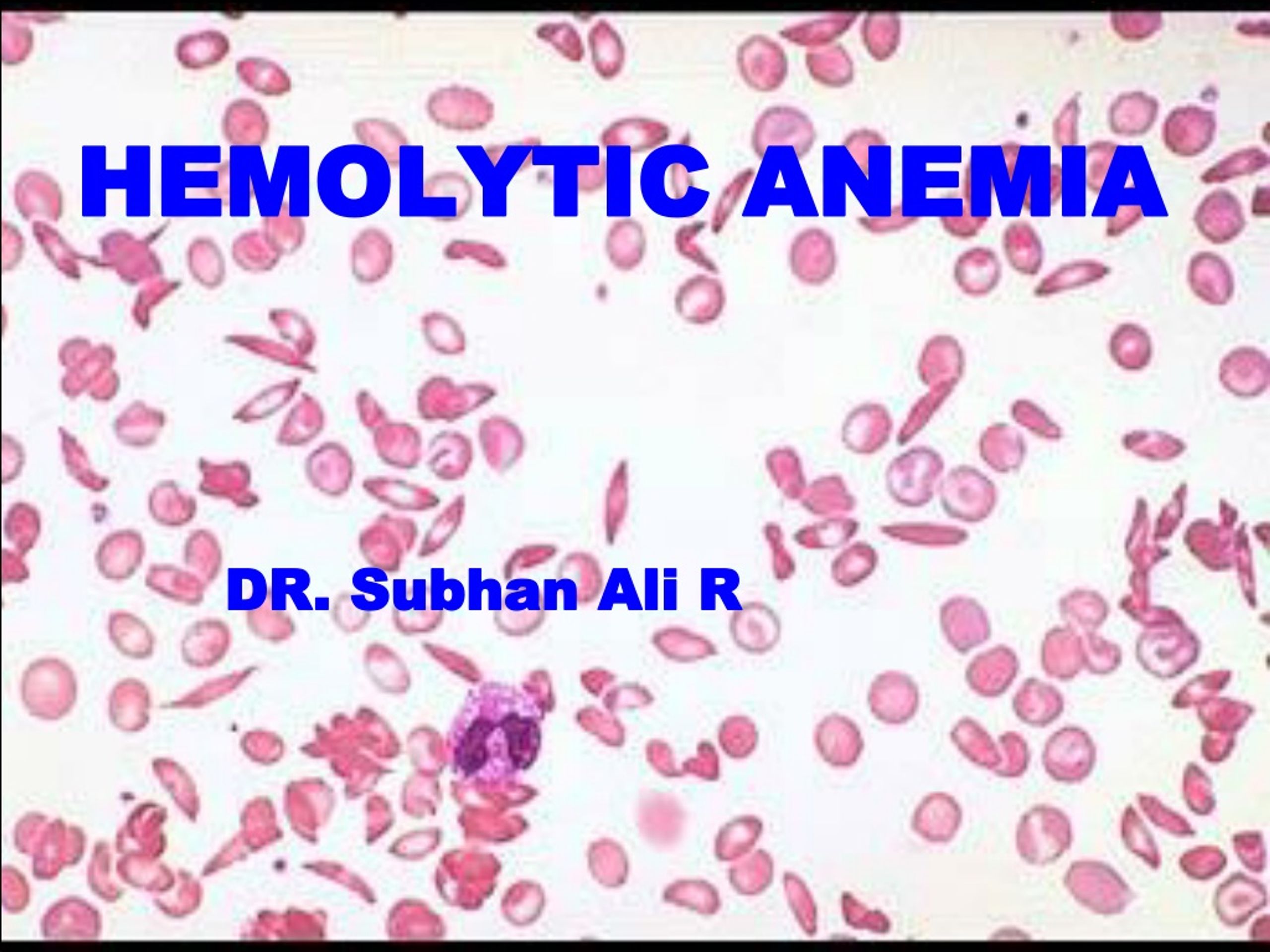 PPT - HEMOLYTIC ANEMIA PowerPoint Presentation, free download - ID:9247334