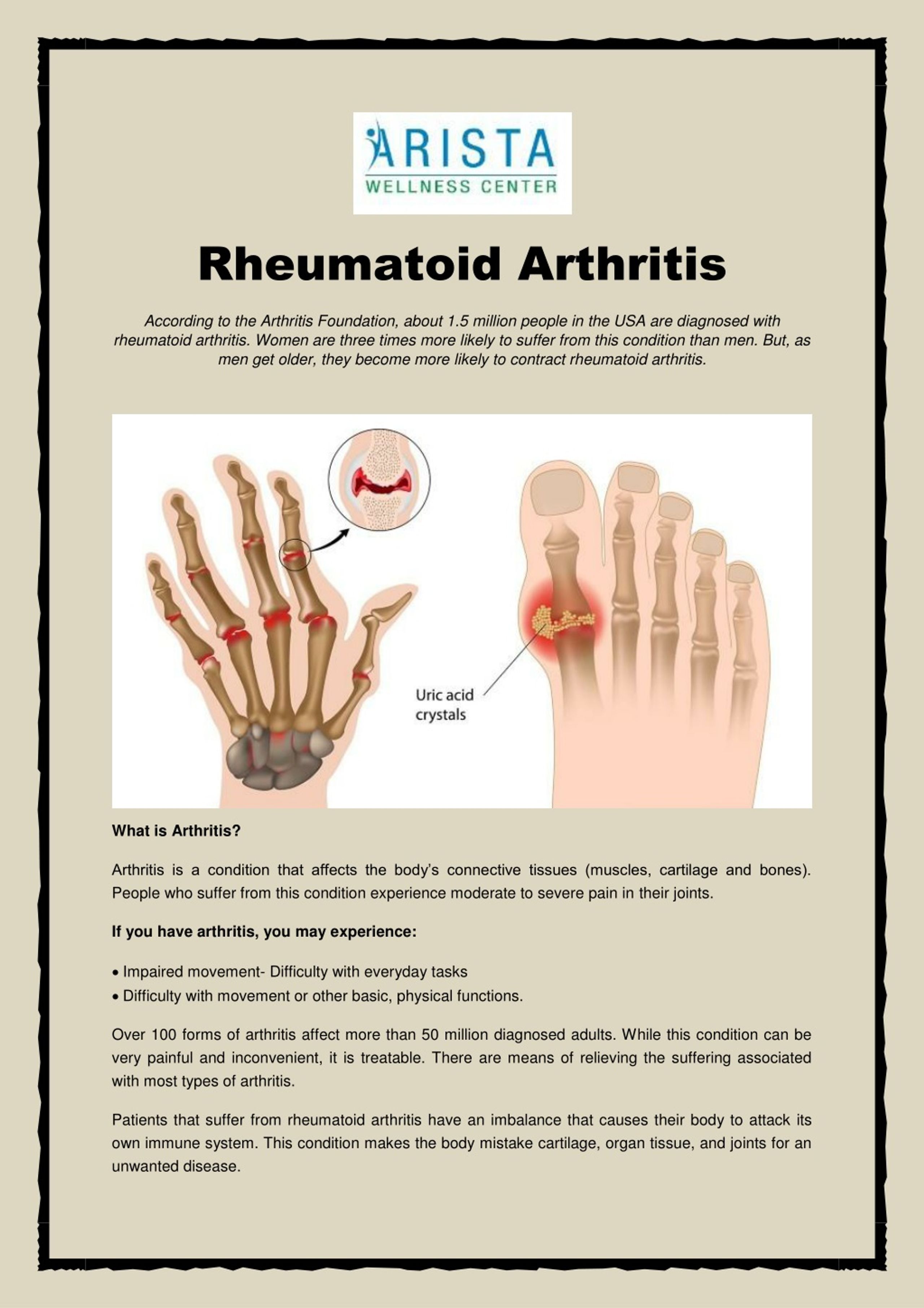 PPT - Rheumatoid Arthritis PowerPoint Presentation, free download - ID ...
